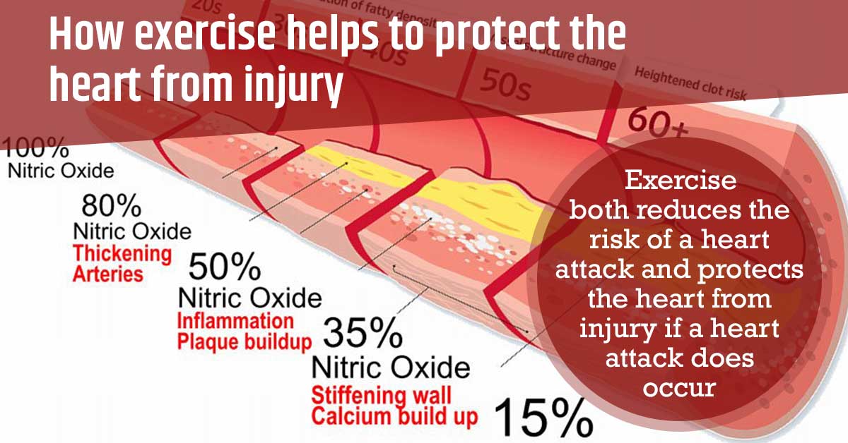 How Exercise Helps to Protect the Heart From Injury